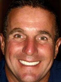 Smile Gallery | Before & After Photos | Dr. Ken Siegel | Blue Bell